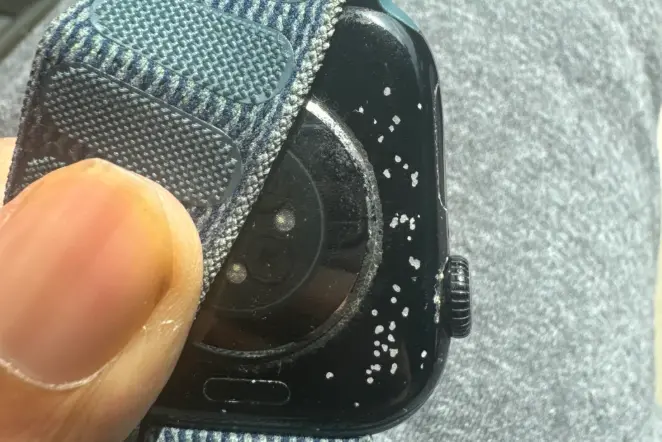 Apple Watch Series 10 Jet Black kaplama şikayetleri hızla yayılıyor ...